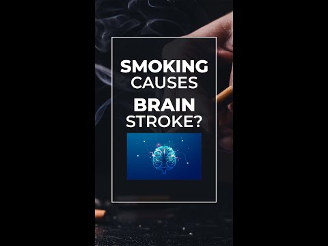 How smoking can cause brain stroke by our Dr Ganesh Veerabhadraiah