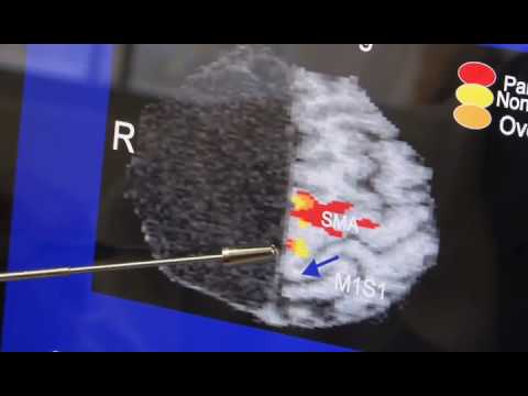 How the Brain Works Part 4 (UCLA)