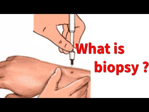 What is Biopsy ? 🤔🤔 @Alearninglane