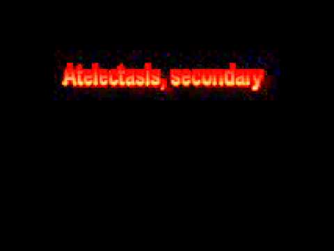 What Is The Definition Of Atelectasis, secondary Medical Dictionary Free Online