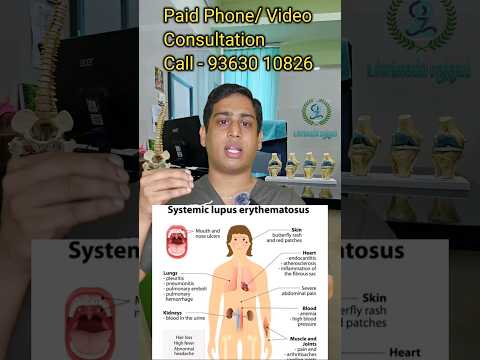 லூபஸ் நோய்|மண்டலிய செம்முருடு நோய்|Systemic Lupus Erythematosus|SLE in Tamil| #autoimmune #drvinoth