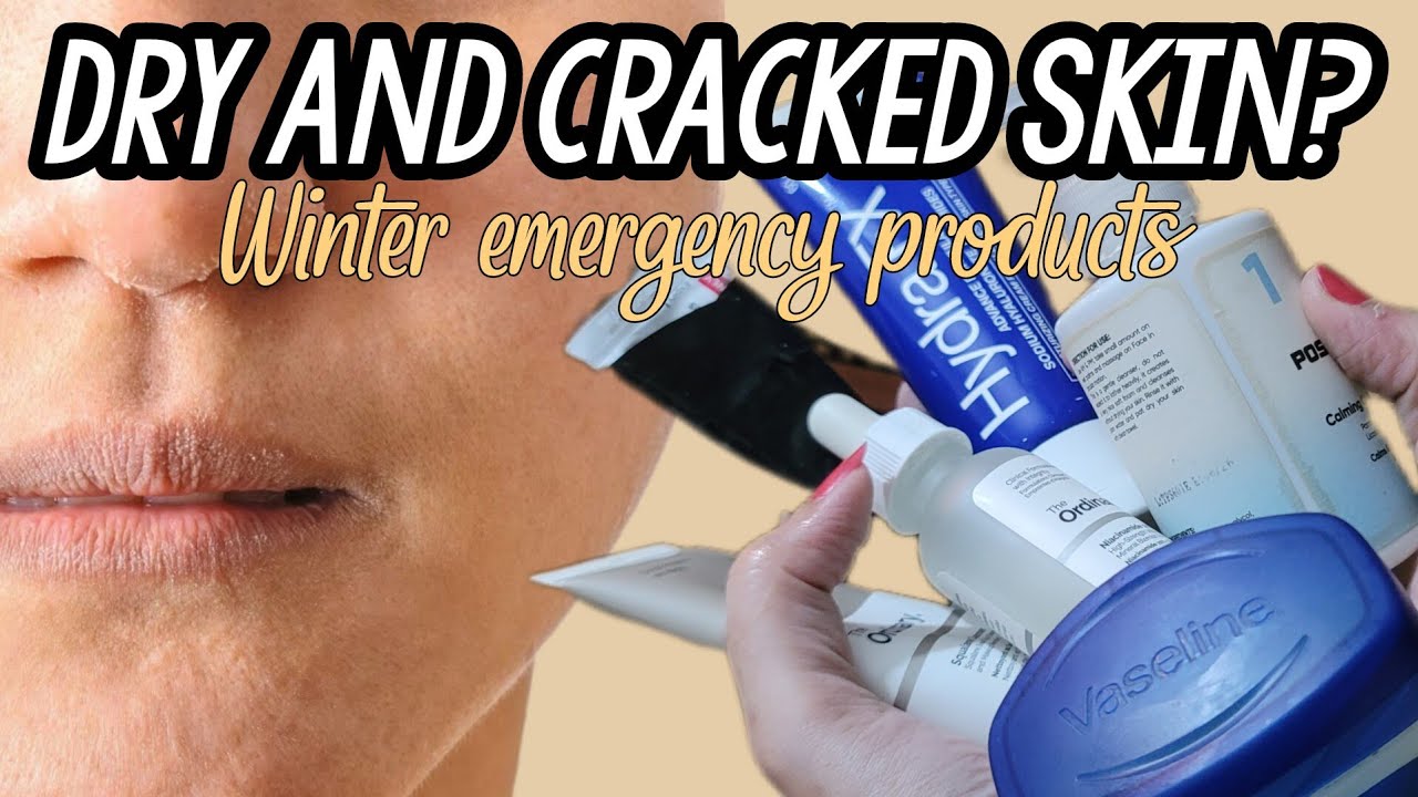 Winter Skin SOS Kit 🔥| Extremely Dry Skin Rescue (Fast Relief!)