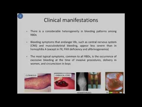 EHC Annual Conference 2013 - Rare Bleeding Disorders, an overview