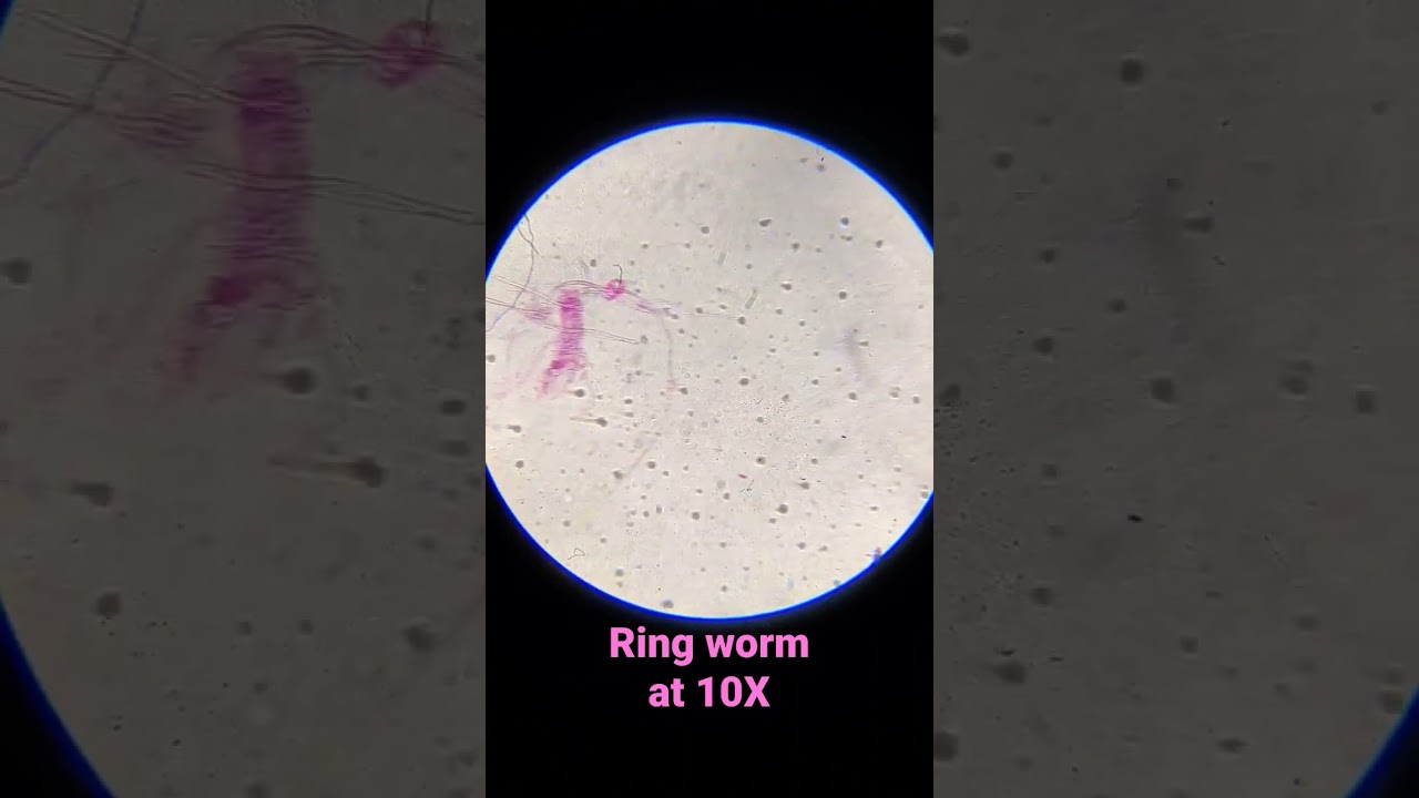 Ring Worm at 10X #shorts
