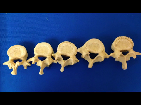 Regional Vertebrae