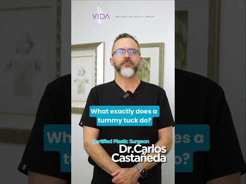 Curious about what exactly is a tummy tuck?🤔Dr.Castañeda explains #plasticsurgery #tummytucksurgery