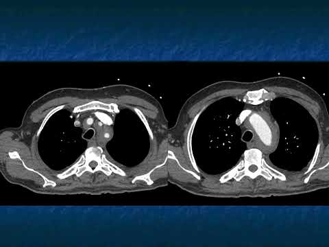 You Make the Call! Freestyle Radiology Quiz #7