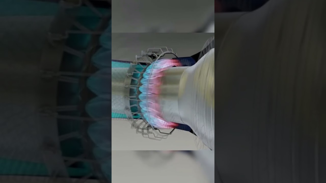 🔥 Annular Combustor Design – How Jet Engines Burn Fuel Efficiently 🔥