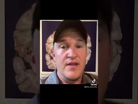 Glioblastoma (TikTok video): Brief Primer.