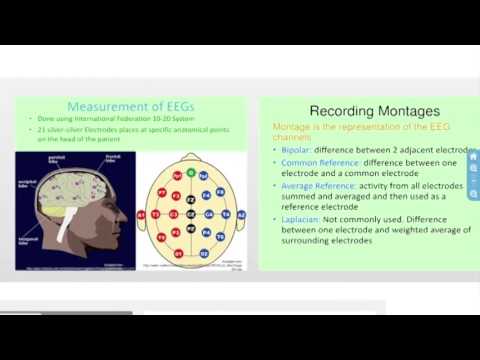 EEG and Action Potentials