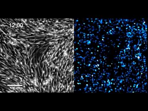 Neural progenitor cells around -1/2 topological defect