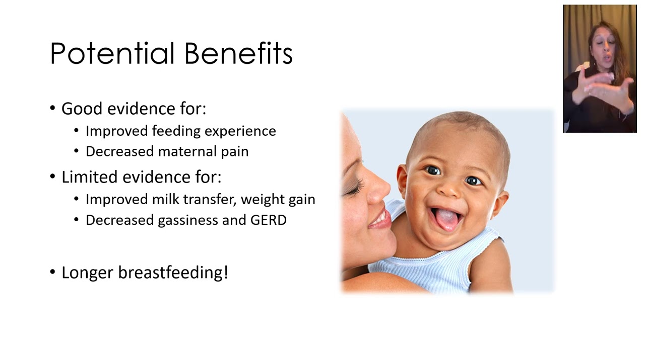 URMC Tongue Tie Parent Education | ASL Version