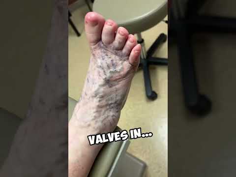 SEE A DOCTOR IF YOU HAVE THIS! 😱#shorts