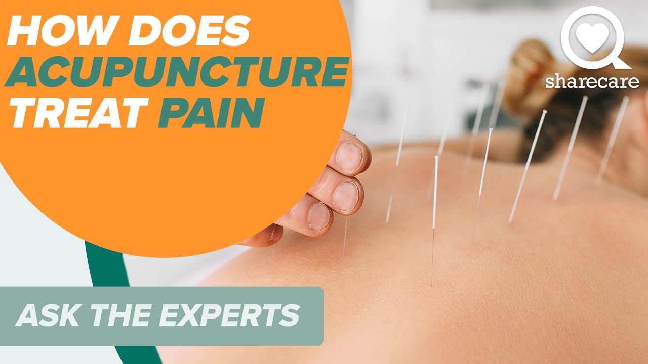 How Does Acupuncture Treat Pain? | Ask The Experts | Sharecare