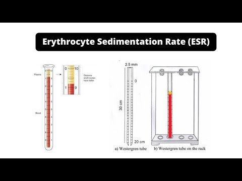 DETERMINATION OF ESR/ERYTHROCYTE SEDIMENTATION RATE#VIRAL#TRENDY#DMLT#BMLT