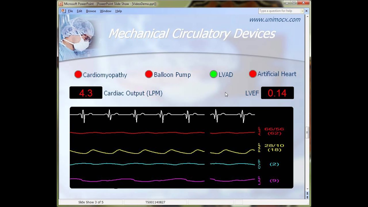 Hemodynamics simulation in PowerPoint using UniMocX