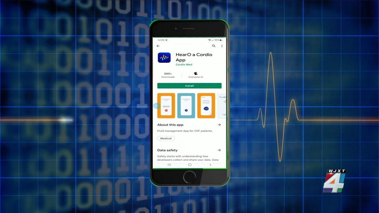 Jacksonville study using AI app to help patients with congestive heart failure