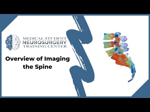 Overview of Imaging the Spine