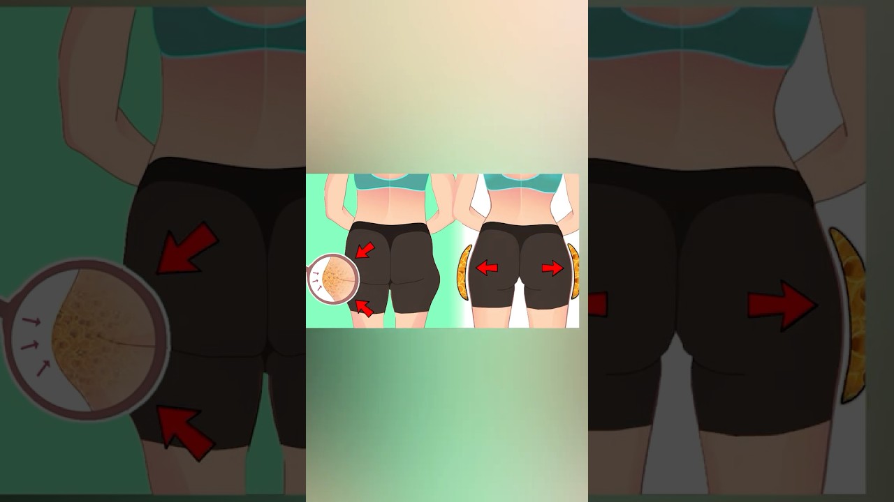 Say Goodbye to Saddlebags and Hip Dips  #workout4d