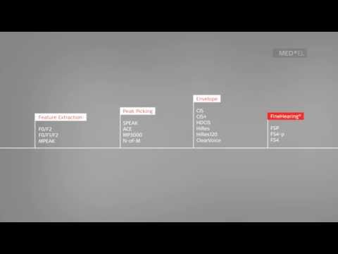 Sound Coding Development | MED-EL