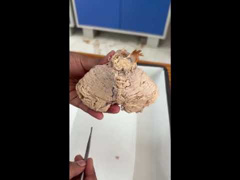 Cerebellum full- CRAMMING WITH SAANAVI, MBBS STUDENT