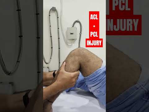 ACL PCL ligament injury in Knee joint | Drawer Test | #aclreconstruction #ligamentinjury #knee