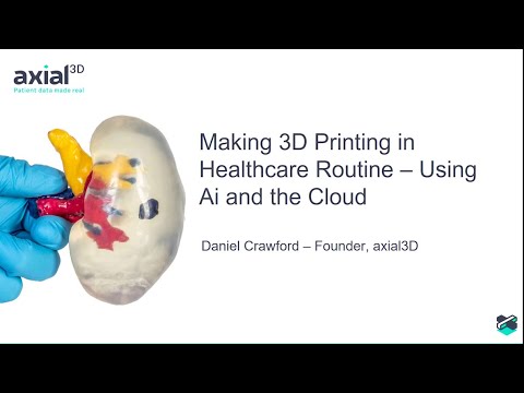 How AI is Transforming How We Create Patient-specific, 3D Printed Models for Pre-operative Planning
