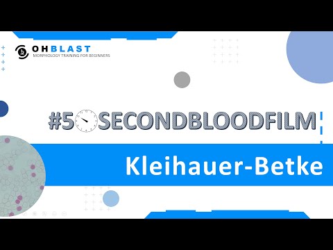 #50SecondBloodFilm: Kleihauer-Betke test