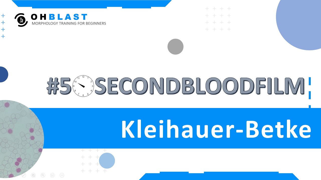 #50SecondBloodFilm​: Kleihauer-Betke test