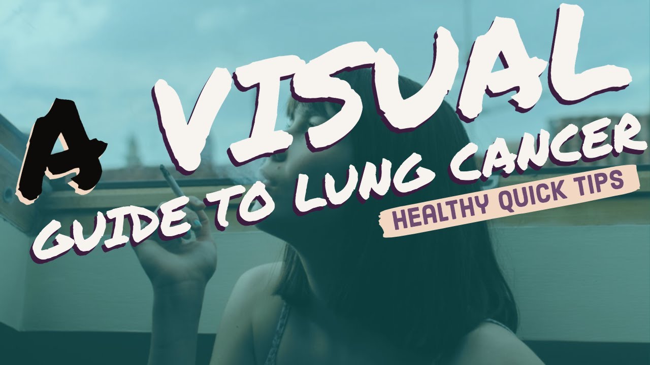 Lung Cancer: A Visual Guide to Lung Cancer (Causes, symptoms, diagnosis, treatment, pathology)