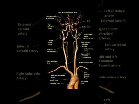 CT Angiography of Head and Neck Anatomy #angiography #neckangio #ctscan #radiology #angiography
