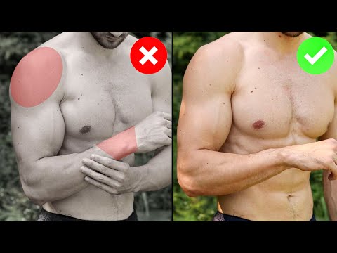 Forget About Injuries FOREVER! (Best Calisthenics Warm Up)