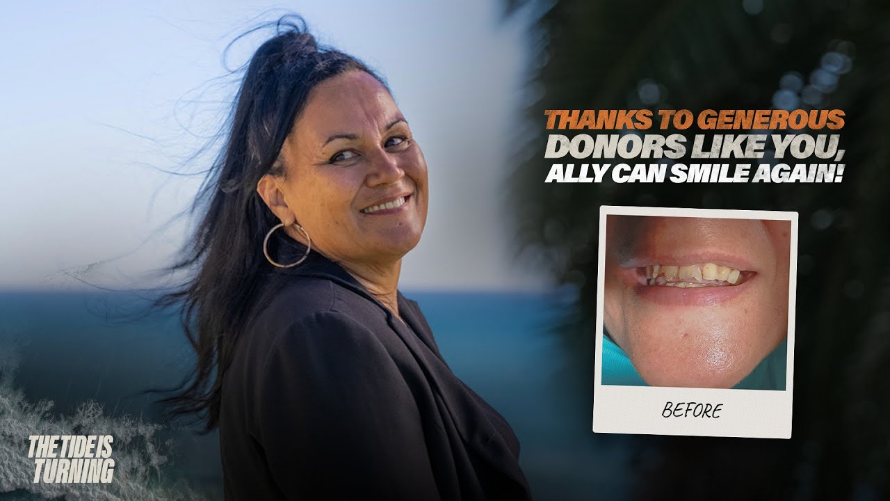 Ally's Survivor Story: Smile Transformation