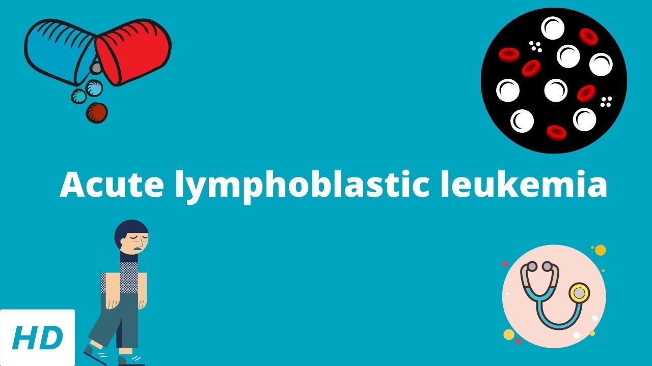 Acute Lymphoblastic Leukemia, Causes, Signs and Symptoms, Diagnosis and Treatment.