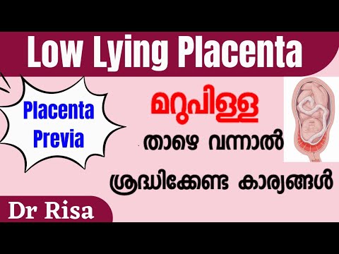 Low Lying Placenta in Pregnancy | Placenta Previa Malayalam