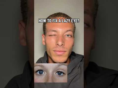 How to fix a lazy eye with eye exercises.