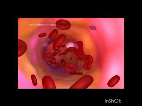 Thrombosis in Urdu/hindi