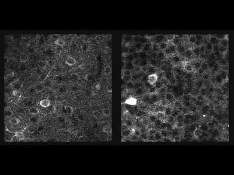 Calcium Activity in Mice Brain