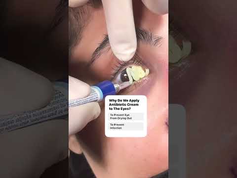 Why Do We Apply Eye Gel Before Surgery? 👁️ | Tap to Learn the Answer!