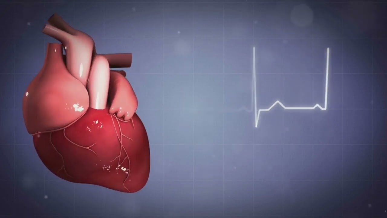 P wave abnormality and disease