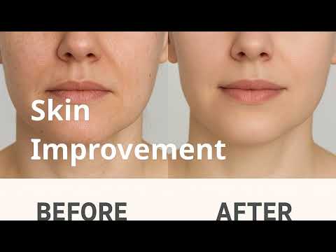Dr. Dennis Gross LED Mask Review 2025 ⚡ Best Anti-Aging & Acne Device? Honest Results!