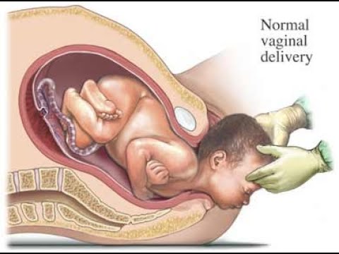 Vaginal delivery CPT code - simplify medical coding
