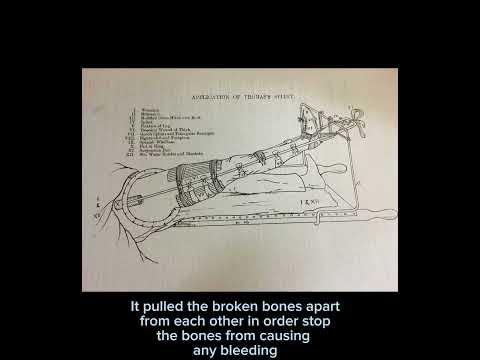 The Thomas Splint
