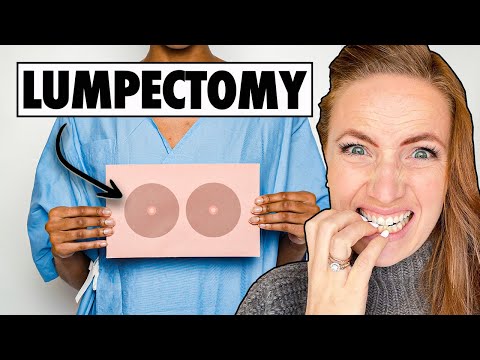 15 Things to Expect After a LUMPECTOMY (DO NOT Miss THIS!)