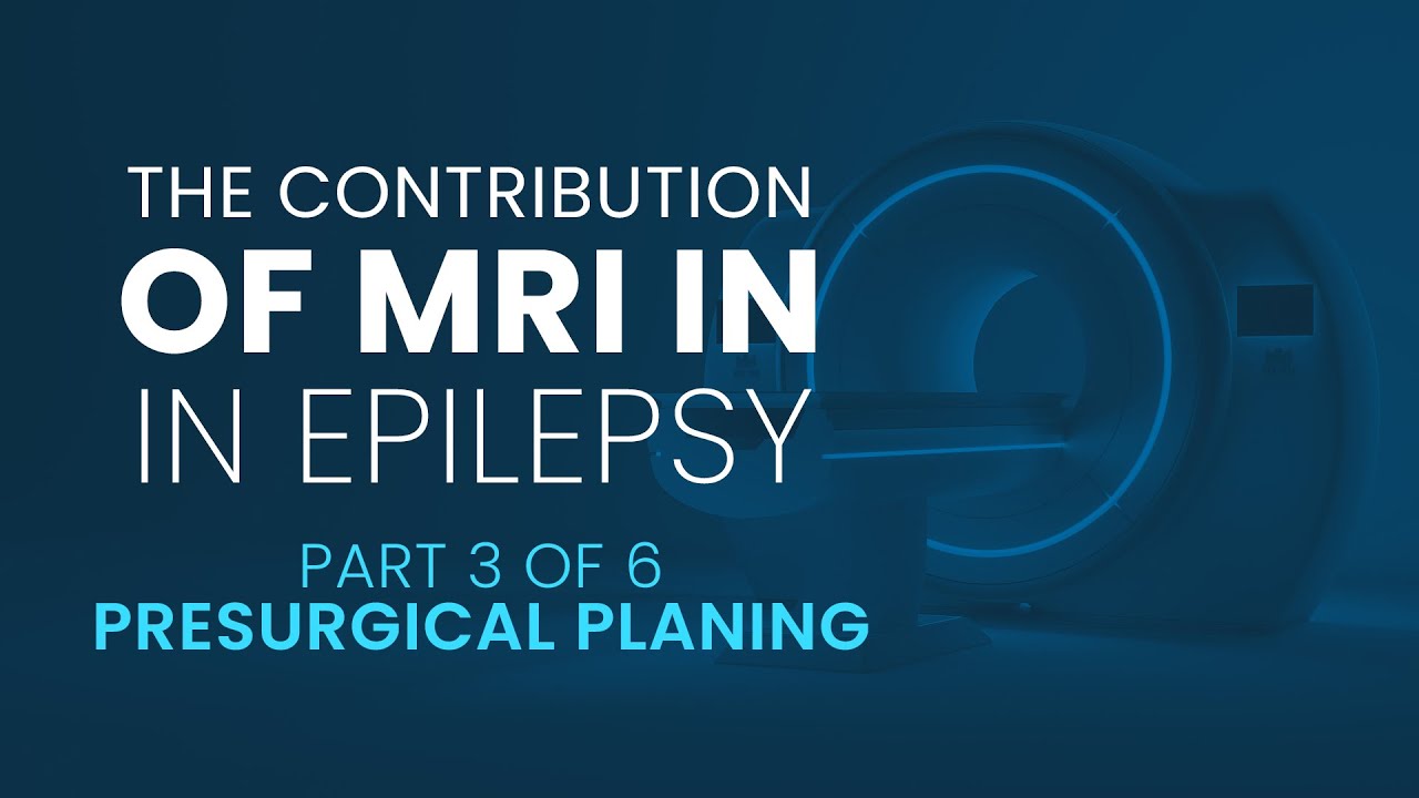 The contribution of MRI in Epilepsy | Part 3 Presurgical Planning