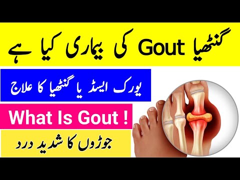What Is Gout (arthritis) Urdu Hindi - Uric Acid Diet Urdu Hindi - Irfan Azeem