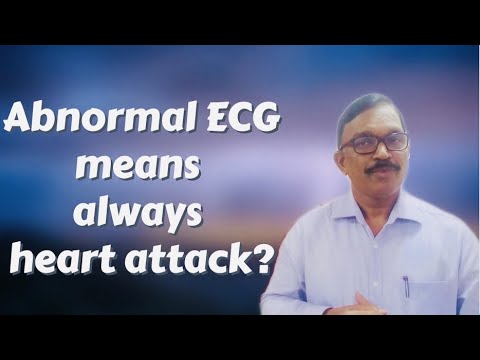 Abnormal ECG means always Heart attack?|| ECG abnormal అయితే Heart attack ఏనా?|| Dr.KMK Reddy