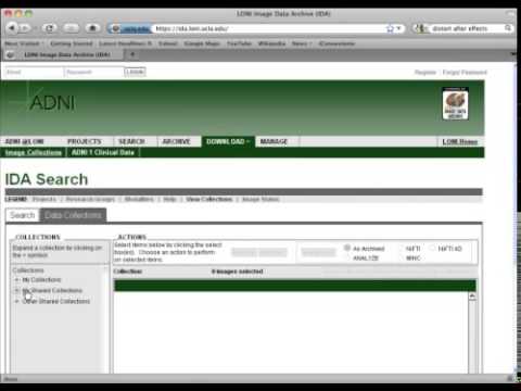 ADNI Data Archive Demo