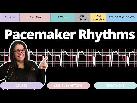ECG Pacemaker Rhythms on an EKG | Circulatory System and Disease | NCLEX-RN | Nurse Cheung