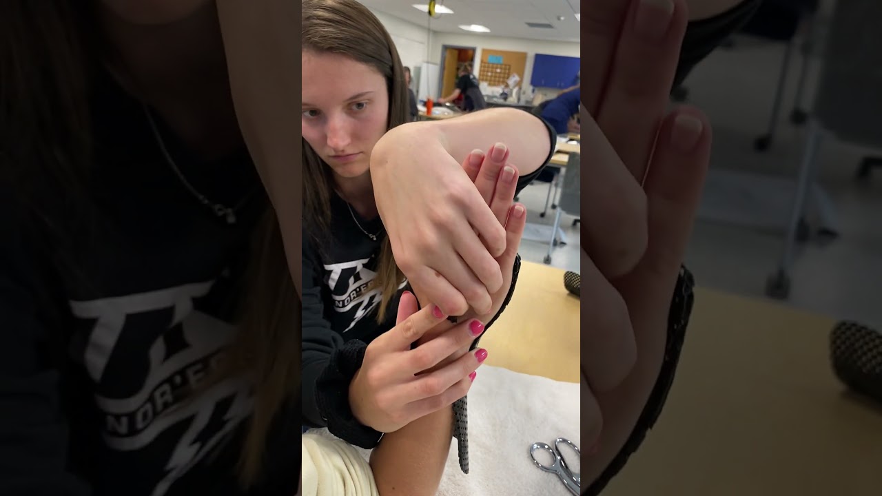 Orthotic Splint Making – UNE Occupational Therapy Lab